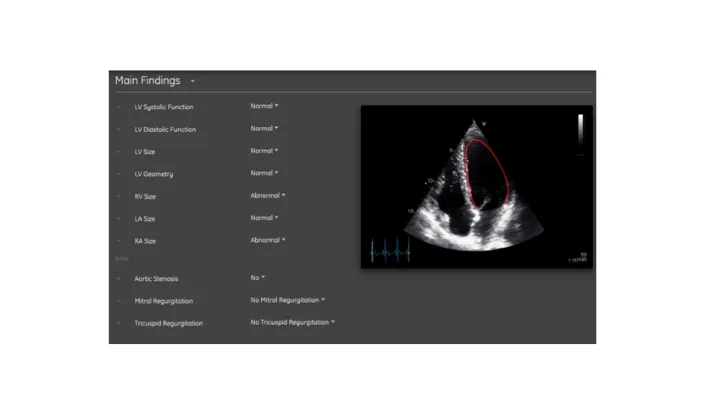 The Future of AI Guided Echo | Us2.ai