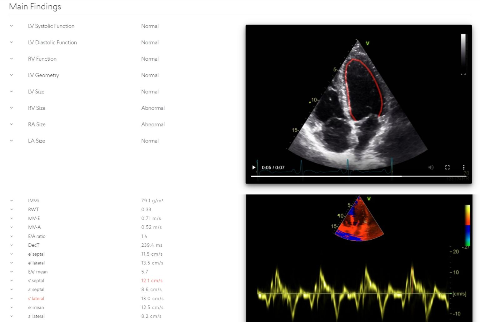 AI for Echocardiography