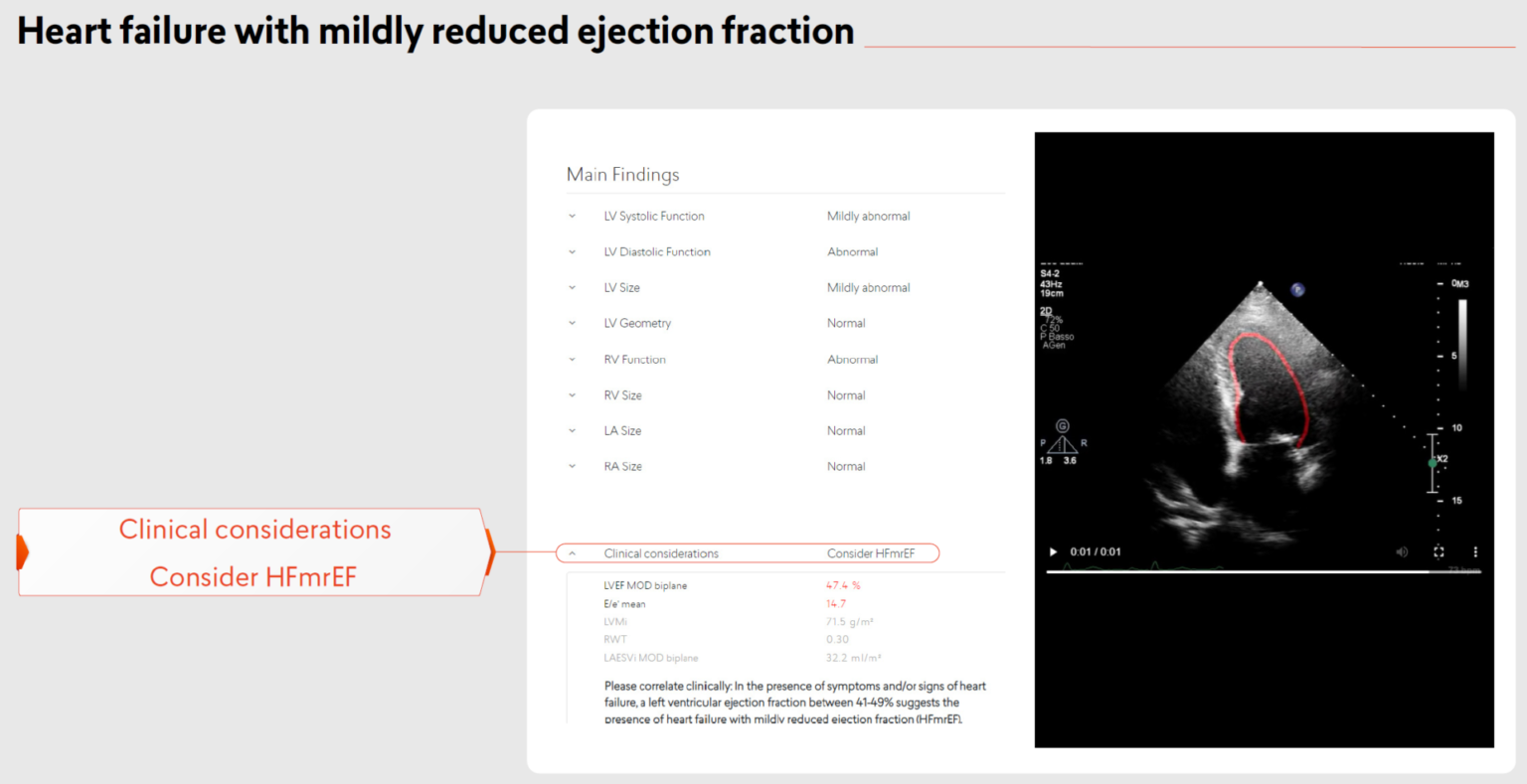 AI Echo White Paper - Us2.ai