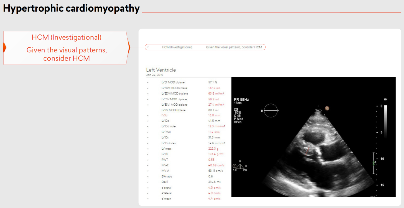 AI Echo White Paper - Us2.ai