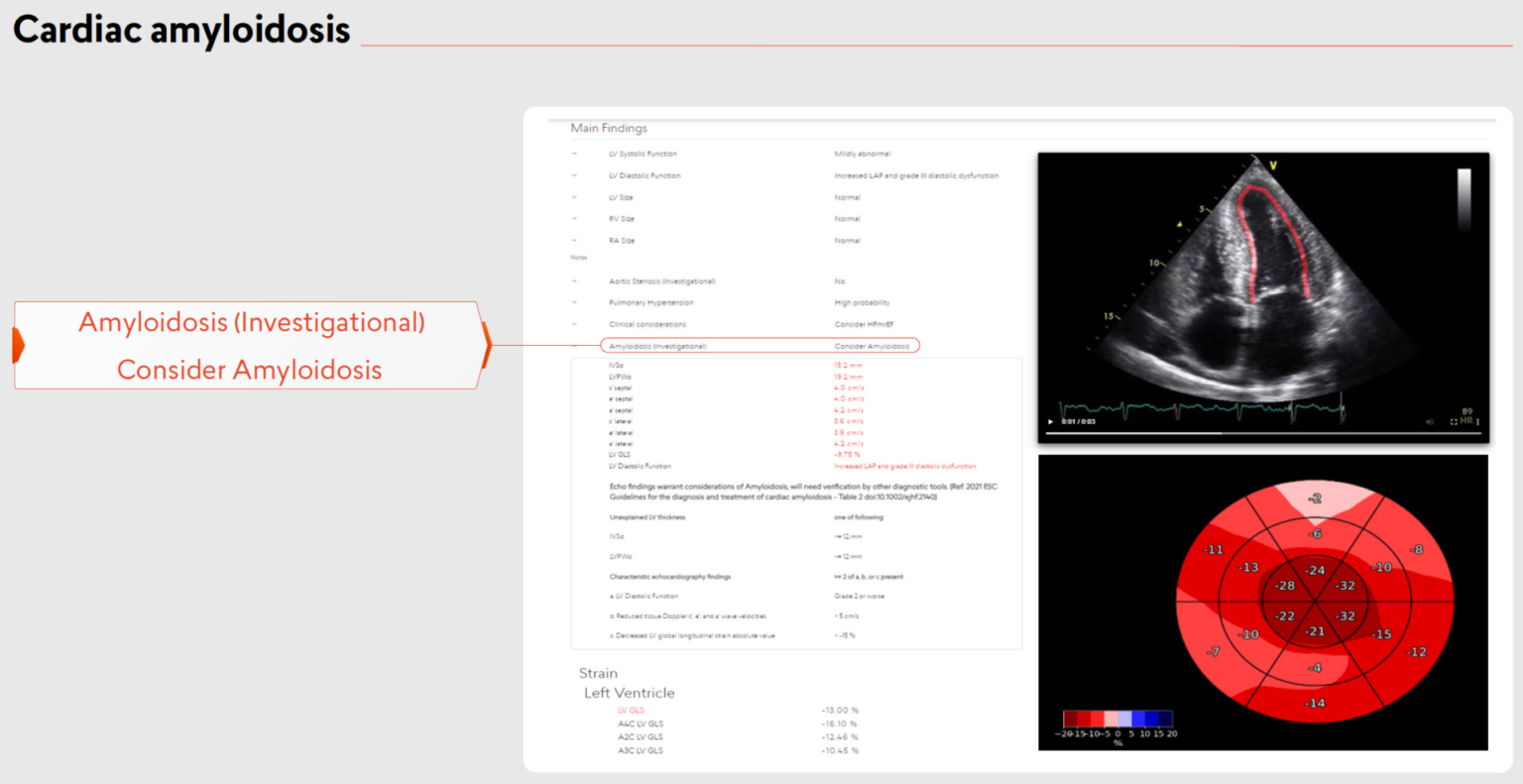 AI Echo White Paper - Us2.ai