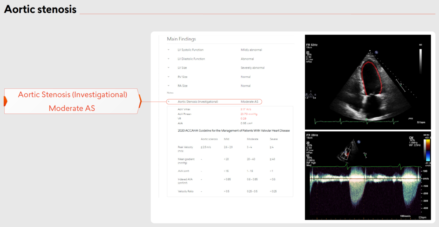 AI Echo White Paper - Us2.ai