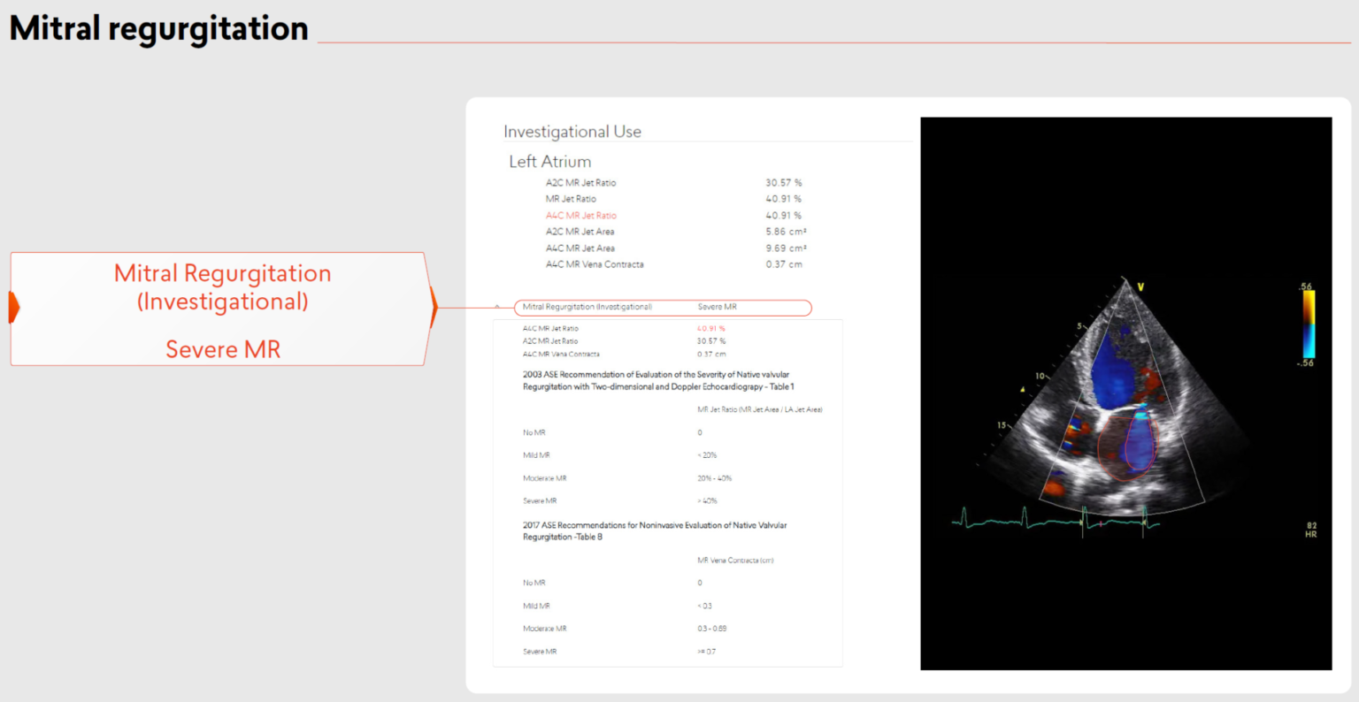 AI Echo White Paper - Us2.ai