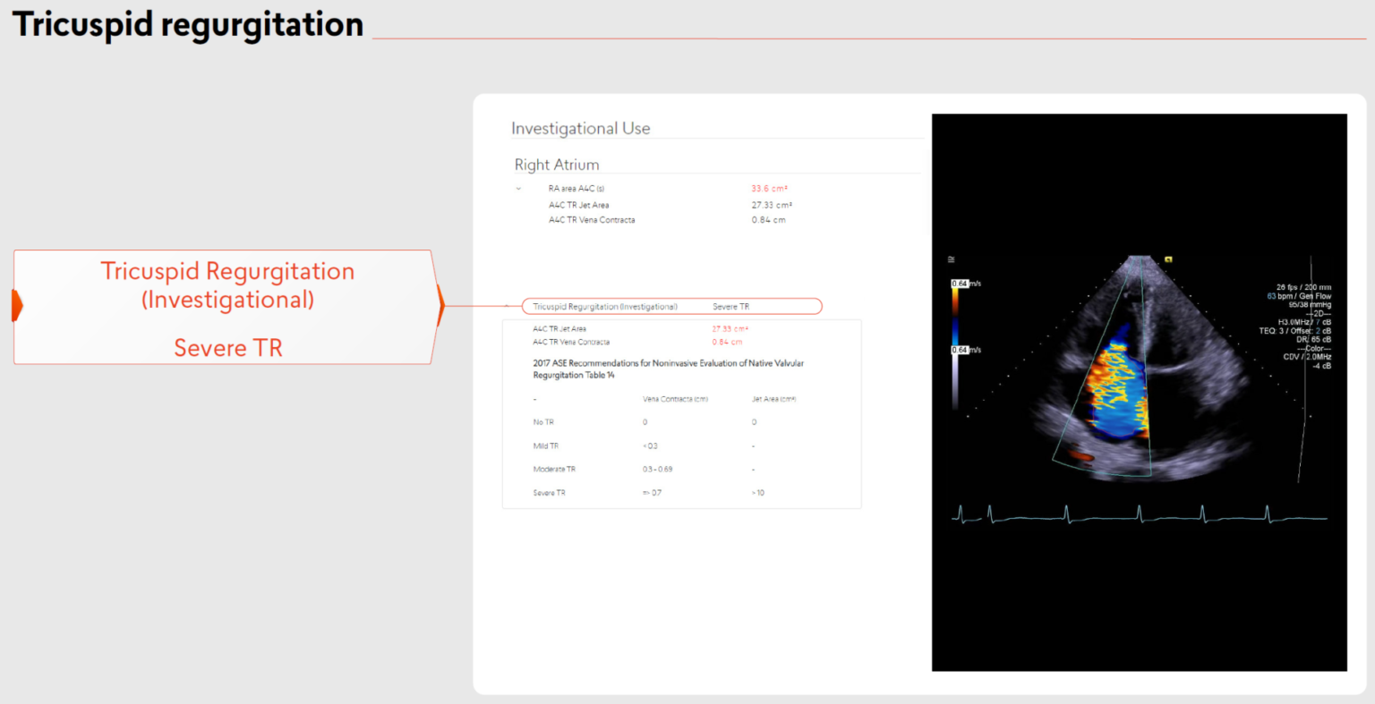 AI Echo White Paper - Us2.ai