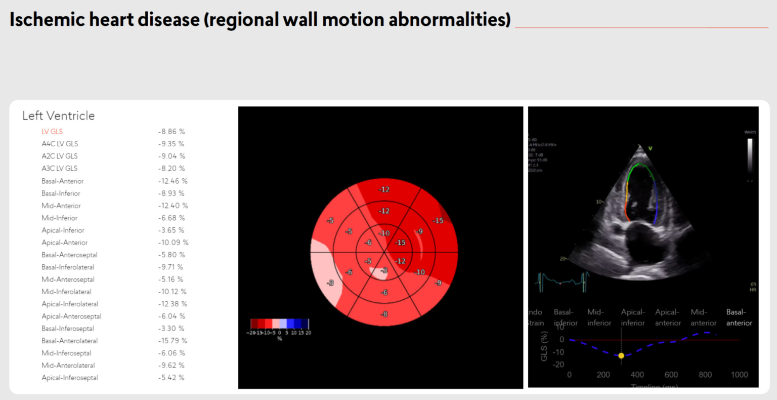 AI Echo White Paper - Us2.ai