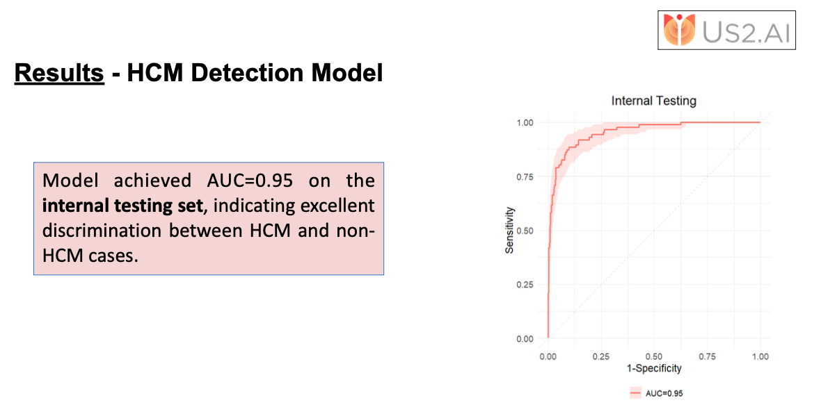 AI-Automated Detection of Hypertrophic Cardiomyopathy by ...
