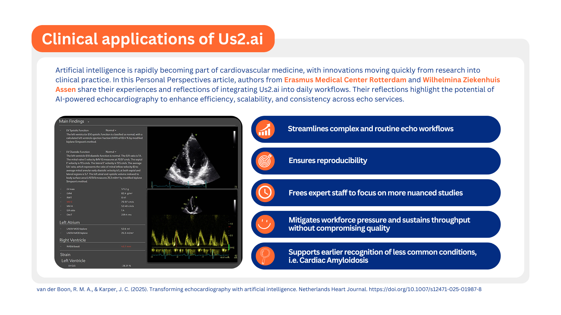 Transforming Echo with AI - Us2.ai